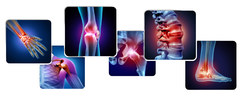 What is the Difference Between OA And RA | ArthritisCARE